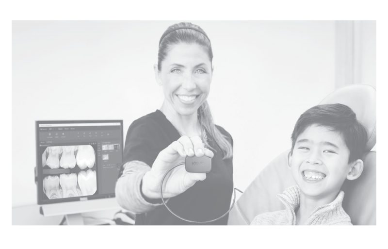 Dexis IXS Sensor - Henry Schein Equipment Australia