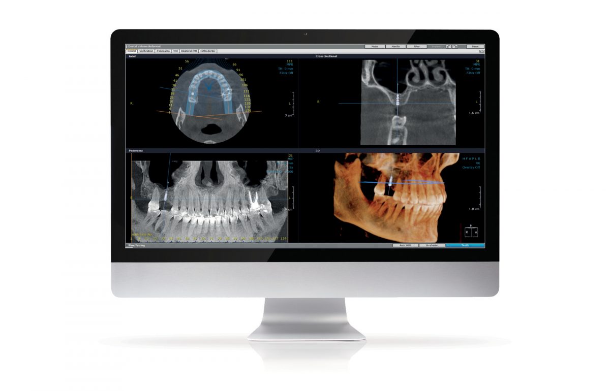 Dexis OP 3D CBCT - Henry Schein Equipment Australia
