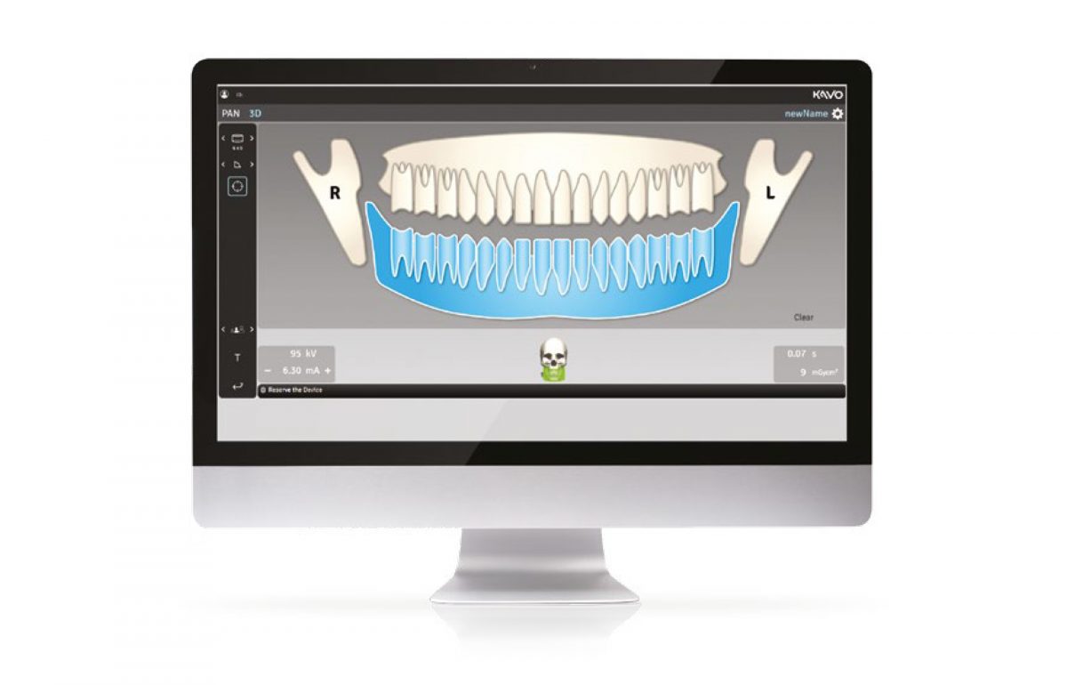 Dexis OP 3D CBCT - Henry Schein Equipment Australia