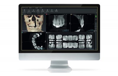 Dexis OP 3D Pro CBCT - Henry Schein Equipment Australia