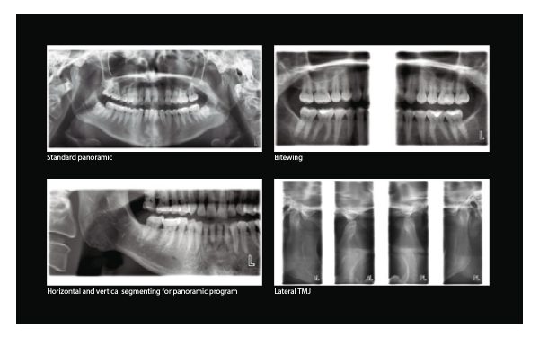 Planmeca ProMax OPG - Henry Schein Equipment Australia