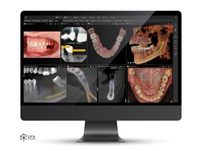 Dexis OP 3D LX CBCT - Henry Schein Equipment Australia