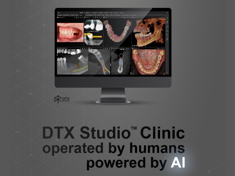 Dexis OP 3D LX CBCT - Henry Schein Equipment Australia